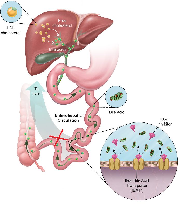 进行性家族性肝内胆汁淤积症靶向药奥德昔巴特（Odevixibat，蓓尔唯，BYLVAY）国内获批上市，附说明书详细解析！ - 知乎
