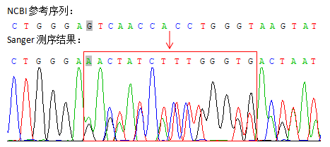 案例分享 | 基因检测助力遗传病诊断——Leber先天性黑矇 - 知乎