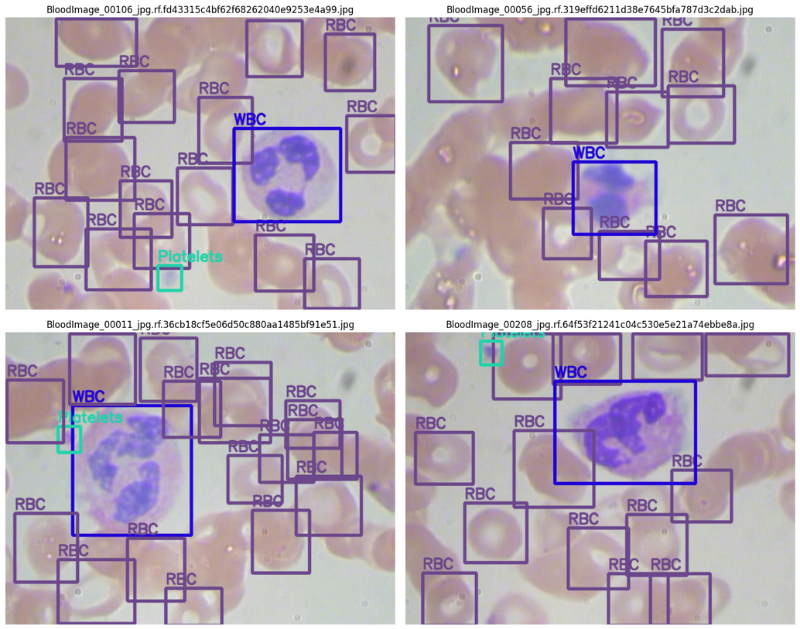 在自定义数据集上训练RetinaNet（ 基于PyTorch ） - 知乎