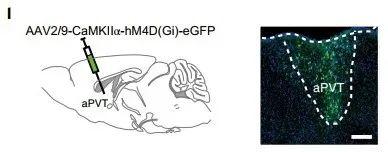 小布解读 | 高热量食物吃到停不下来该怪谁？aPVT脑区小胶质细胞介导强迫性进食“惹的祸” - 知乎