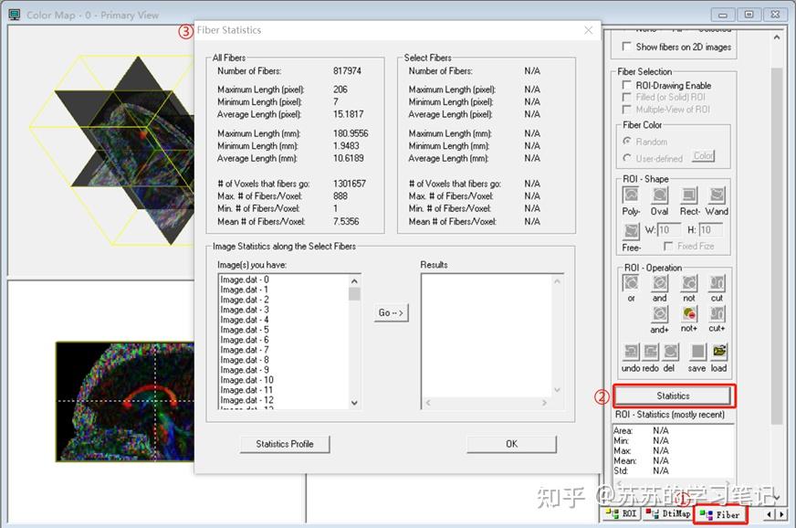DTI Studio操作教程 - 知乎