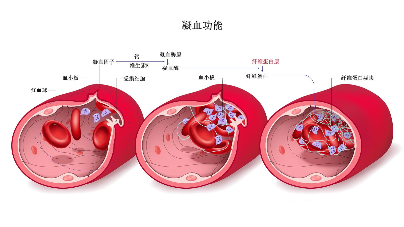 冷沉淀替代方案！Fibryga获批用于治疗获得性纤维蛋白原缺乏症 - 知乎