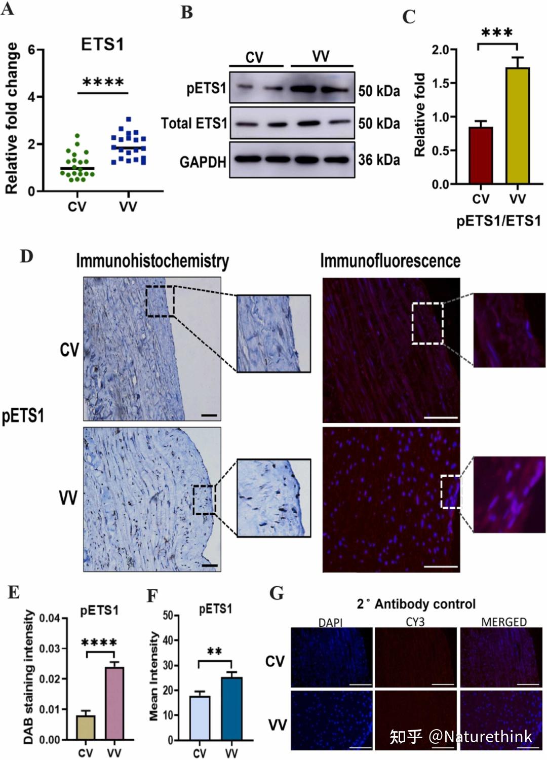 机械反应性 ETS1 通过 NOTCH4/DLL4 信号导致静脉曲张内皮功能障碍和动脉化 - 知乎