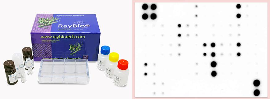 Nature Metabolism（IF：19.865）|RayBio抗体芯片助力脓毒症疾病发展机制研究 - 知乎