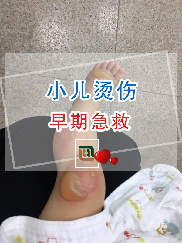 小儿烫伤早期急救 - 知乎