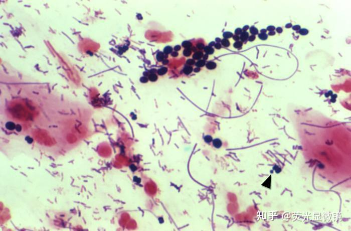 显微镜下的白假丝酵母菌 - 知乎