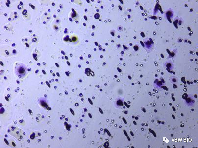 Transwell侵袭实验——入门篇 - 知乎