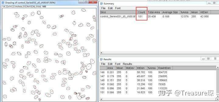 有哪些实用的ImageJ使用技巧？ - 知乎
