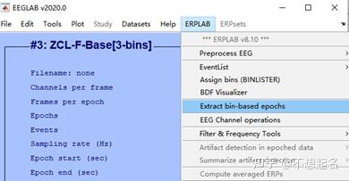 基于Matlab EEGLAB（ERPLAB）工具箱的脑电EEG分析教程 - 知乎