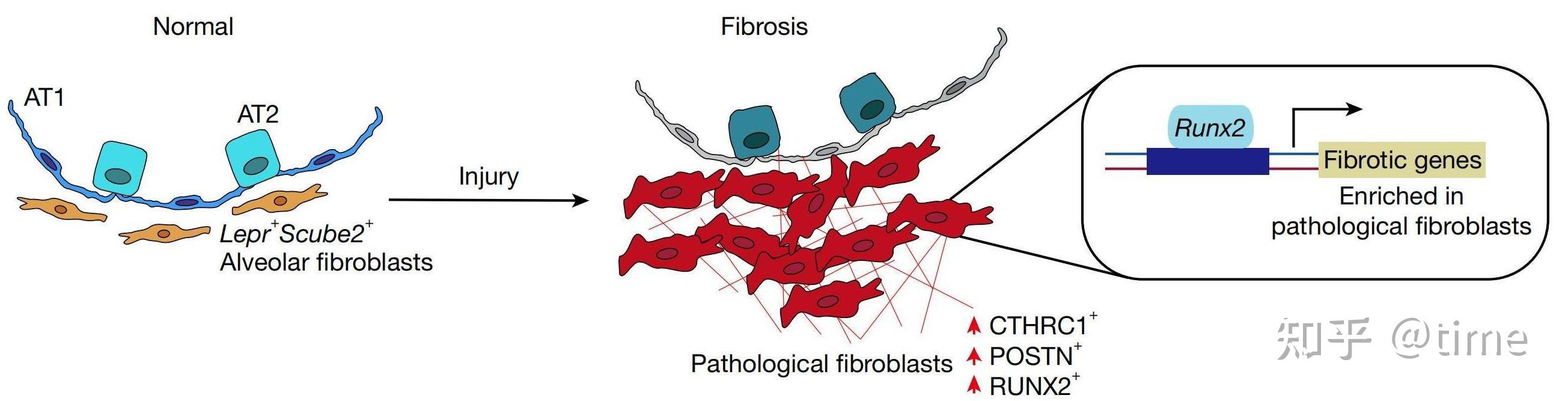 文献分享 | Nature：RUNX2通过肺泡-to-病理性成纤维细胞转化促进纤维化 - 知乎