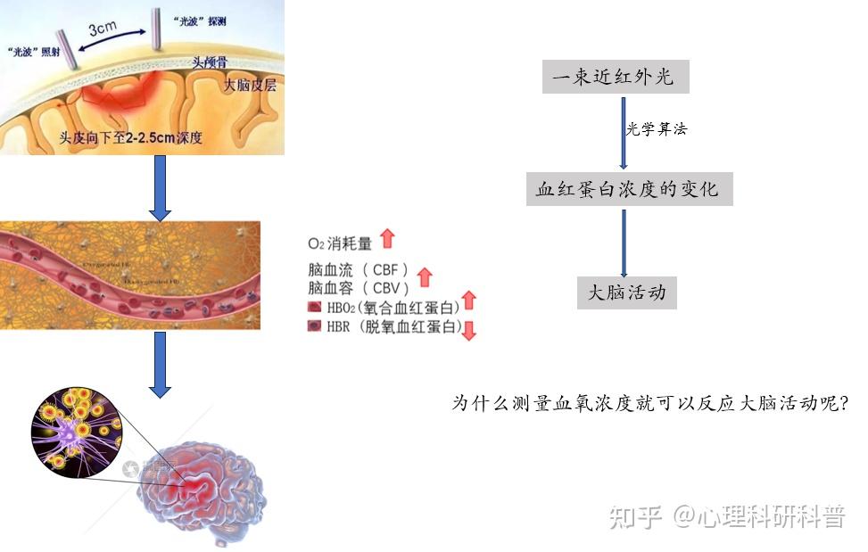 fNIRS系列（一）：fNIRS与其他技术比较，优缺点？ - 知乎