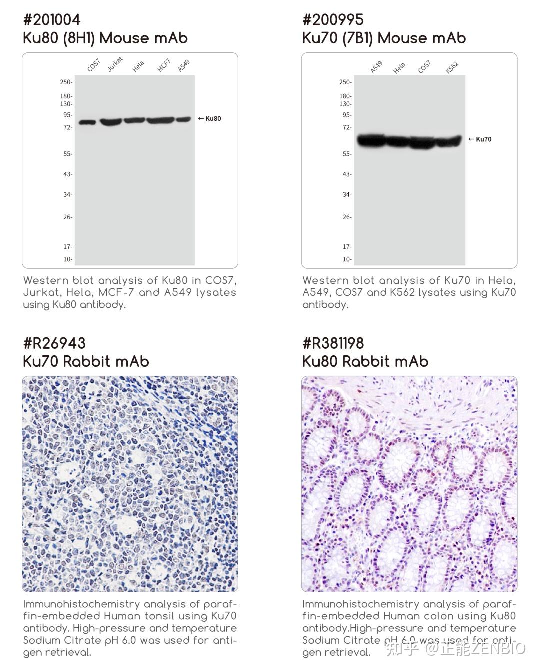 解密DNA修复中的关键力量：Ku70/80蛋白 - 知乎