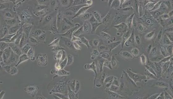 LS1034人结肠腺癌细胞的处理方法与培养步骤！ - 知乎