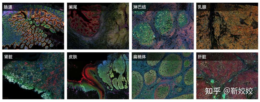 10x Genomics重磅推出Xenium蛋白检测Panel，实现原位RNA+蛋白质共检测！ - 知乎