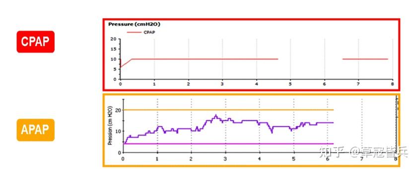 打呼噜是用CPAP呼吸机还是APAP呼吸机? - 知乎