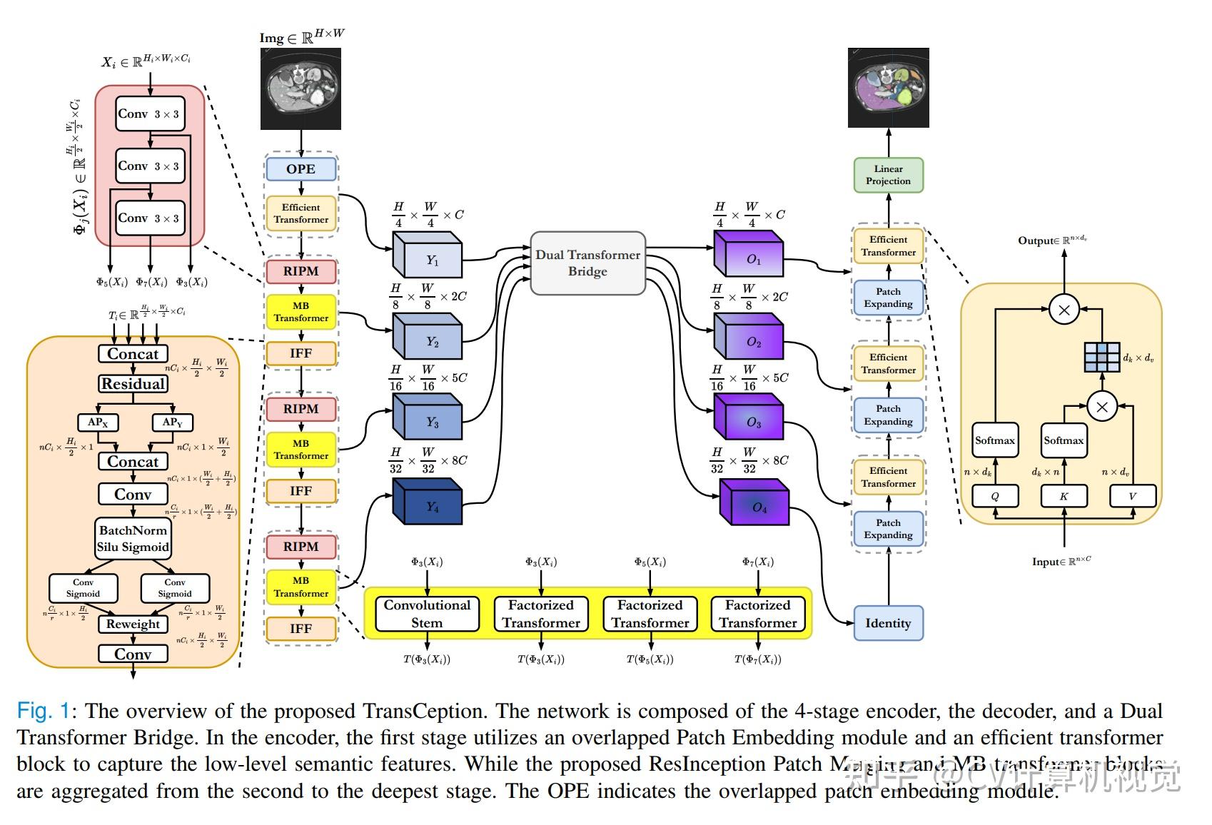 基于Transformer的医学图像分割15篇论文及开源代码 - 知乎