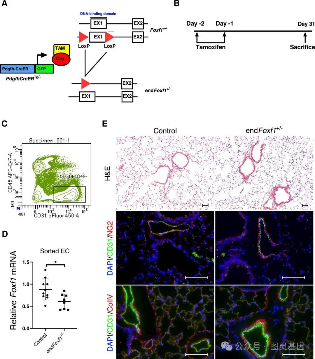 EMBO Mol Med | 发现肺癌转移新靶点：FOXF1 - 知乎