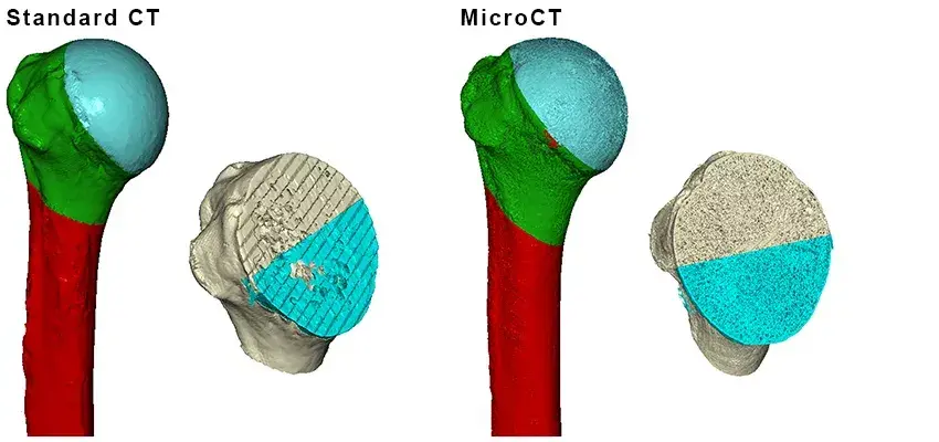 【Simpleware】通过三维计算机断层扫描测量骨密度的验证 - 知乎