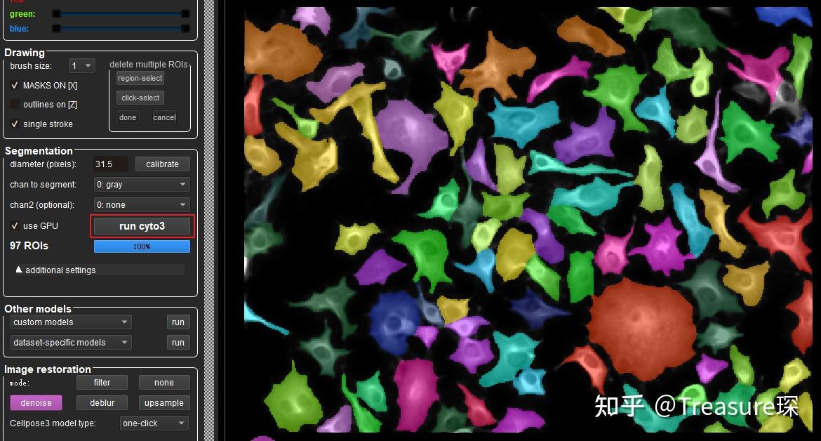 Cellpose 3.0 —— 一键图像恢复+细胞分割 - 知乎