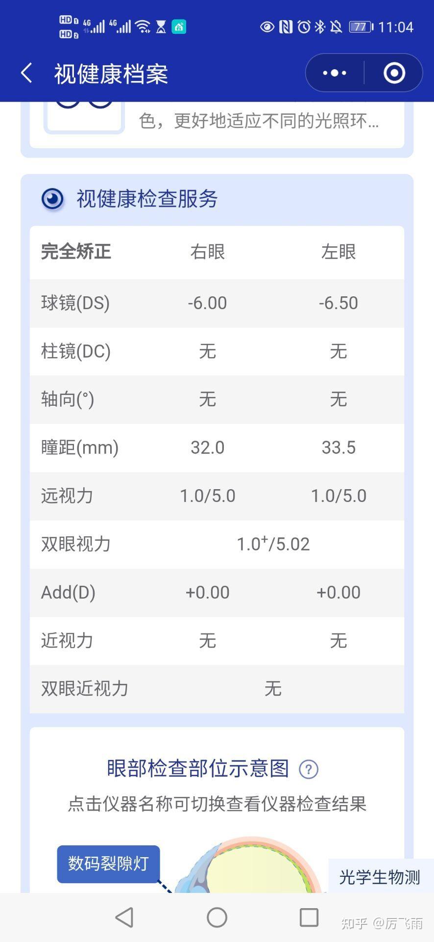 Endmyopia恢复视力实操记录（11月21更新） - 知乎