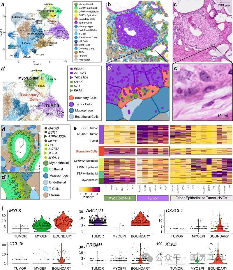 Nat Comm | 10x Genomics团队用单细胞、空间和原位分析技术联合绘制高分辨率肿瘤微环境图谱 - 知乎