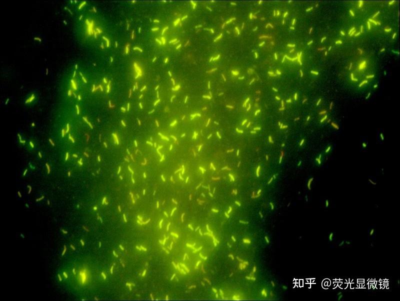 显微镜能怎样看细菌？ - 知乎