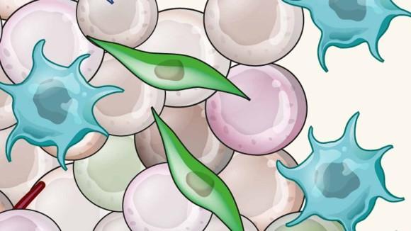 Nat Comm | 10x Genomics团队用单细胞、空间和原位分析技术联合绘制高分辨率肿瘤微环境图谱 - 知乎