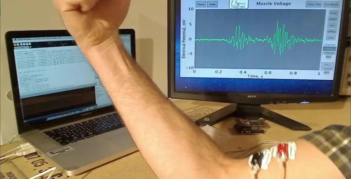 表面肌电诊断技术临床应用 - 知乎