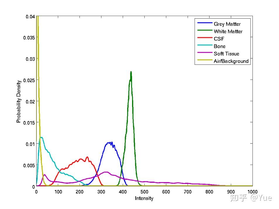 00_医学影像学习_MRI_VBM - 知乎