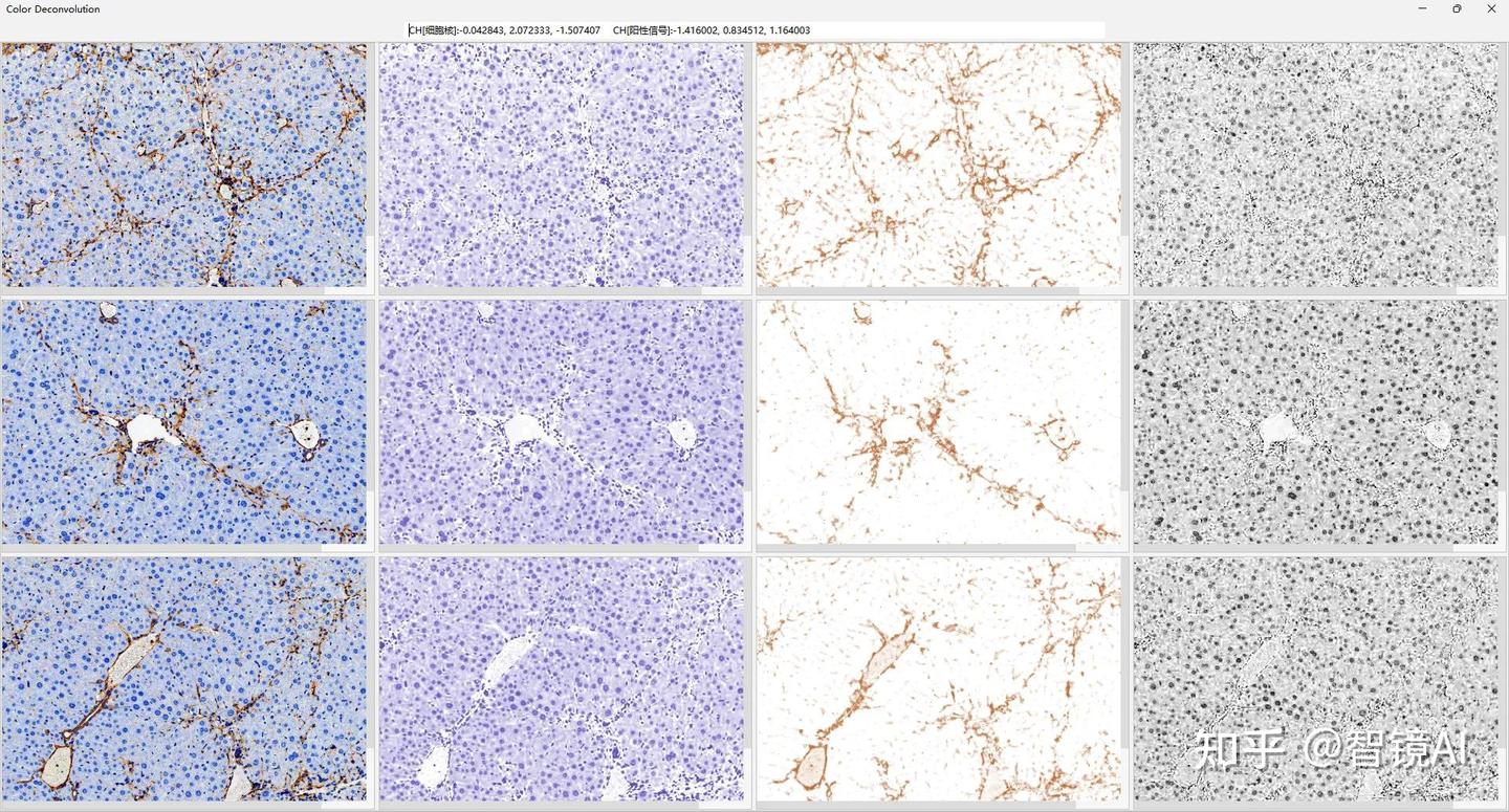 【Color Deconvolution】IHC 颜色解卷通道分离完整教程 - 知乎
