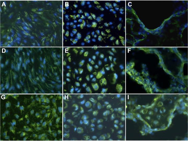 鉴定祖细胞对异位骨发生的贡献 - 知乎