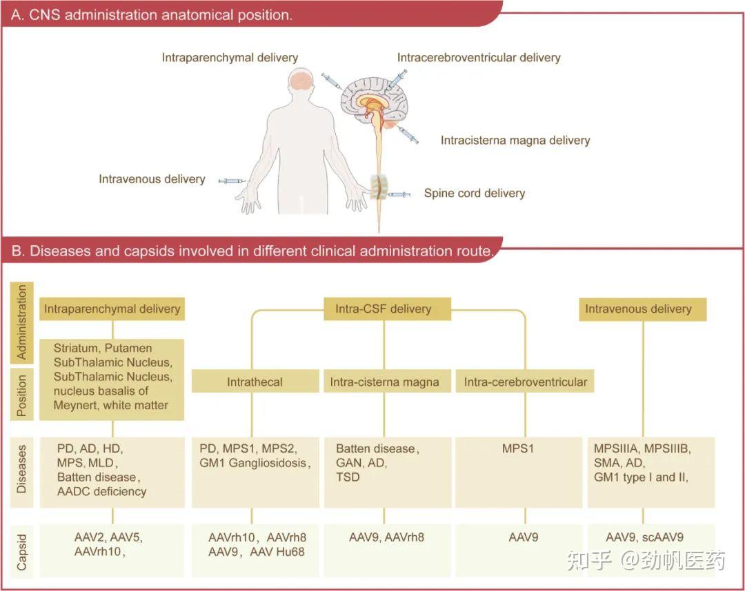 AAV基因治疗在CNS疾病领域的临床现状和挑战 - 知乎
