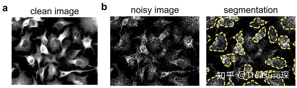 Cellpose 3.0 —— 一键图像恢复+细胞分割 - 知乎