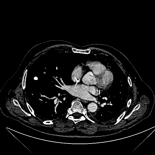 SimpleITK的使用 - 知乎
